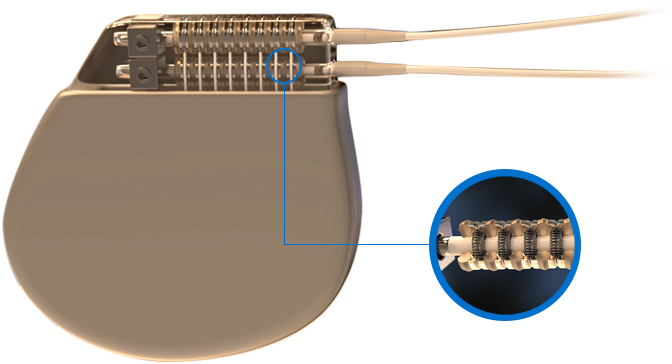Medical Technologies | Bal Seal Engineering