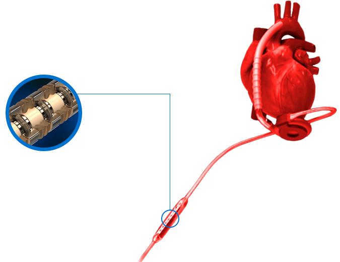 Medical Technologies | Bal Seal Engineering