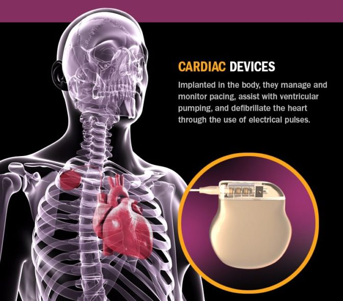 Cardiac Device Design Infographic | Bal Seal Engineering