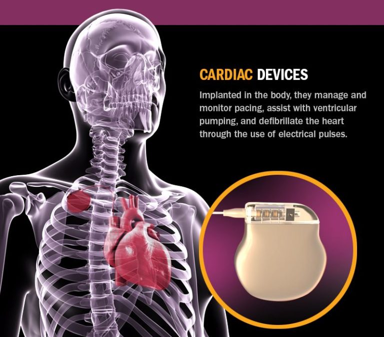 Cardiac Device Design Infographic | Bal Seal Engineering